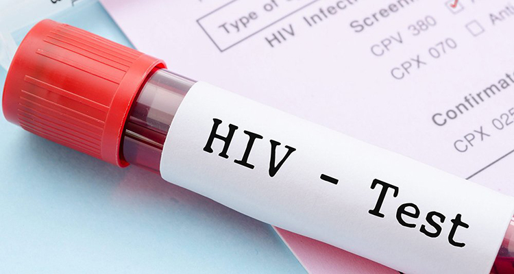 La estrecha y frecuente relación entre el VIH y el cáncer